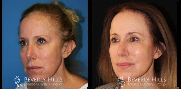 Gallery - Dr. John C. Layke DO