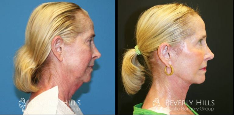 Gallery - Dr. John C. Layke DO