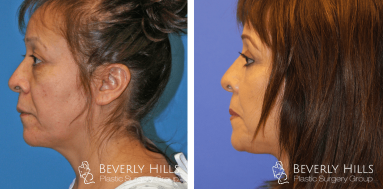 Gallery - Dr. John C. Layke DO