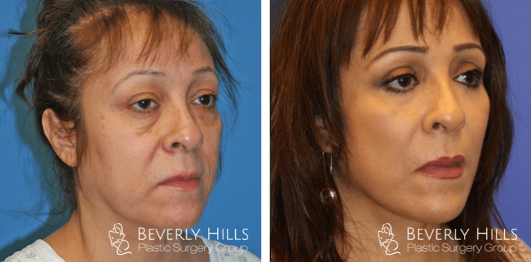 Gallery - Dr. John C. Layke DO