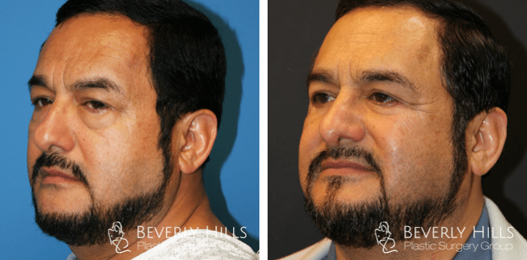 Gallery - Dr. John C. Layke DO