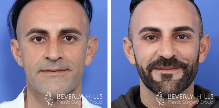 Gallery - Dr. John C. Layke DO