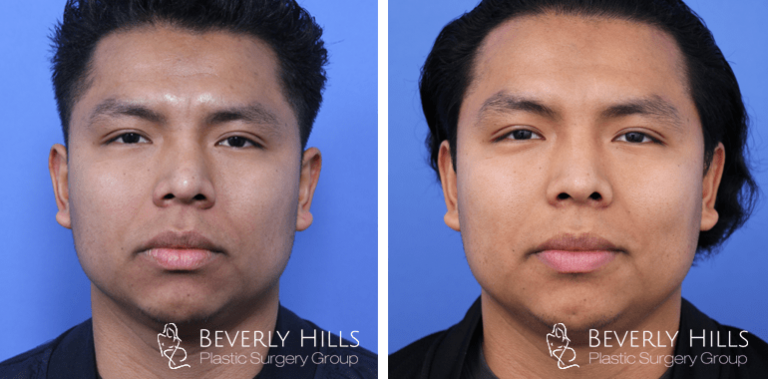 Gallery - Dr. John C. Layke DO