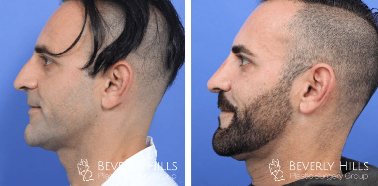 Gallery - Dr. John C. Layke DO