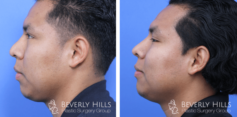 Gallery - Dr. John C. Layke DO