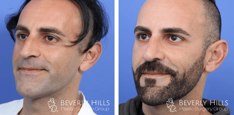 Gallery - Dr. John C. Layke DO