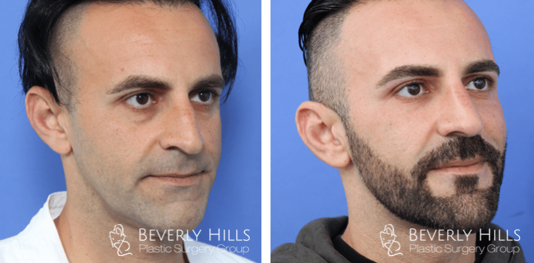 Gallery - Dr. John C. Layke DO